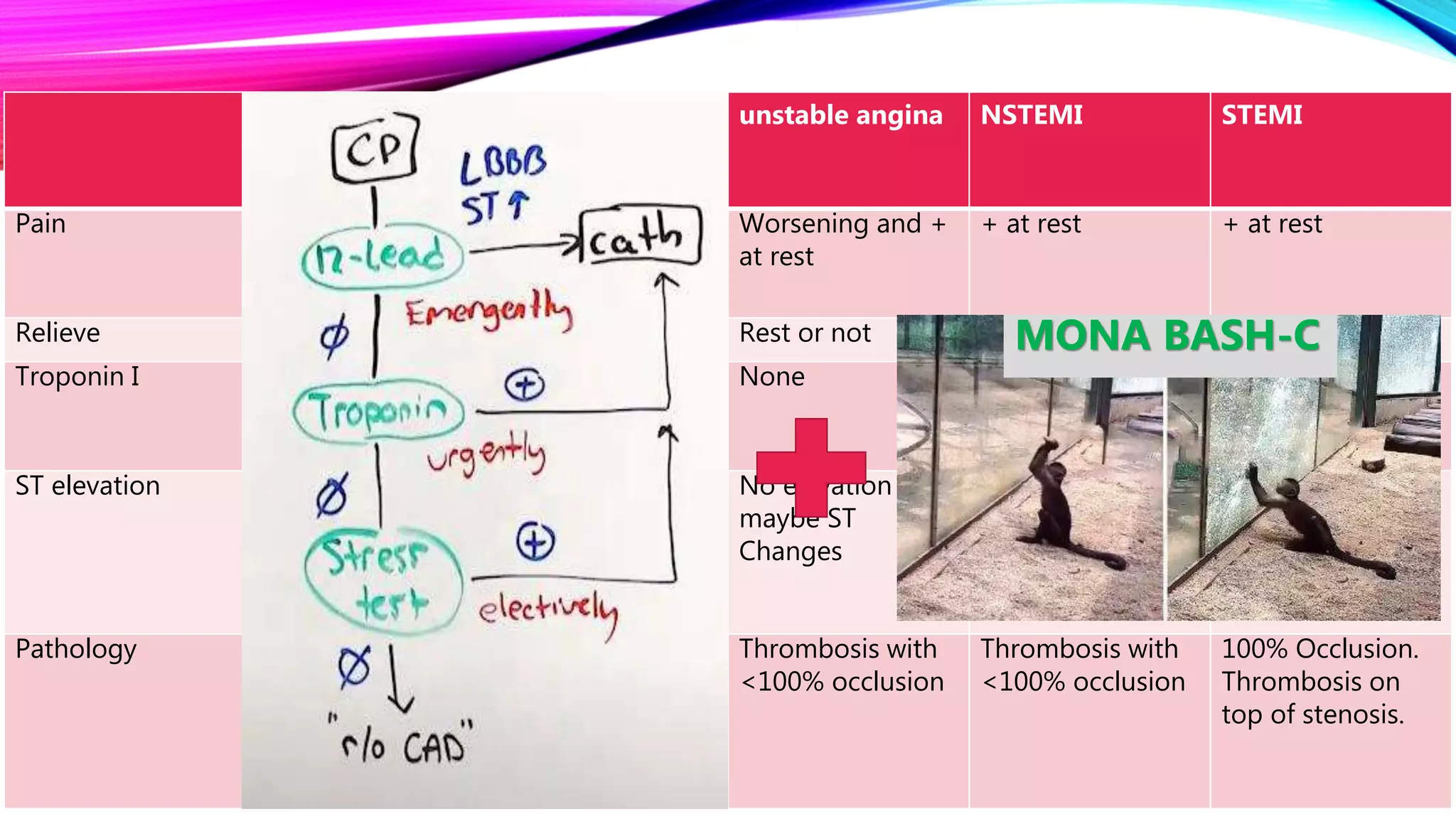 Coronary Artery Disease / Acute Myocardial Infarction ppt | PPTX