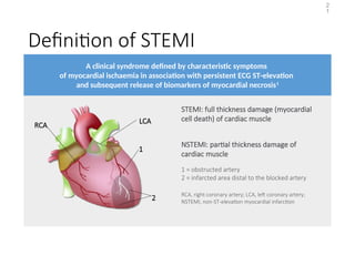 cad-stemi.pptcad-stemi.pptcad-stemi.pptcad-stemi.ppt