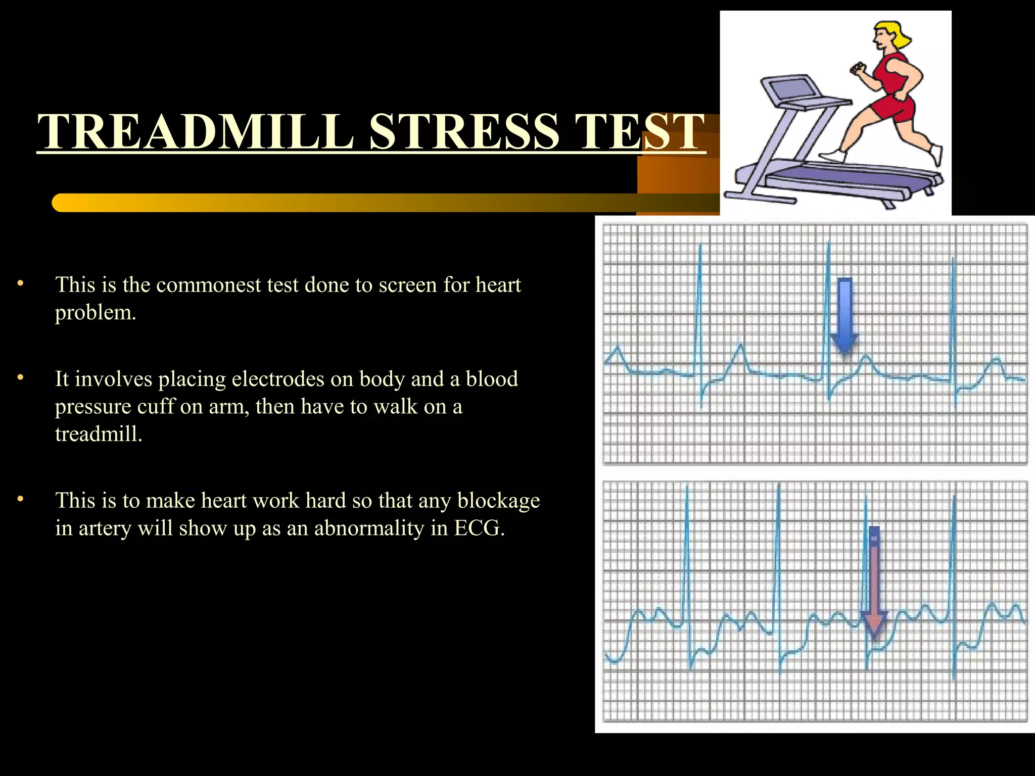 Coronary artery disease : CAD, atherosclerotic heart disease | PPT