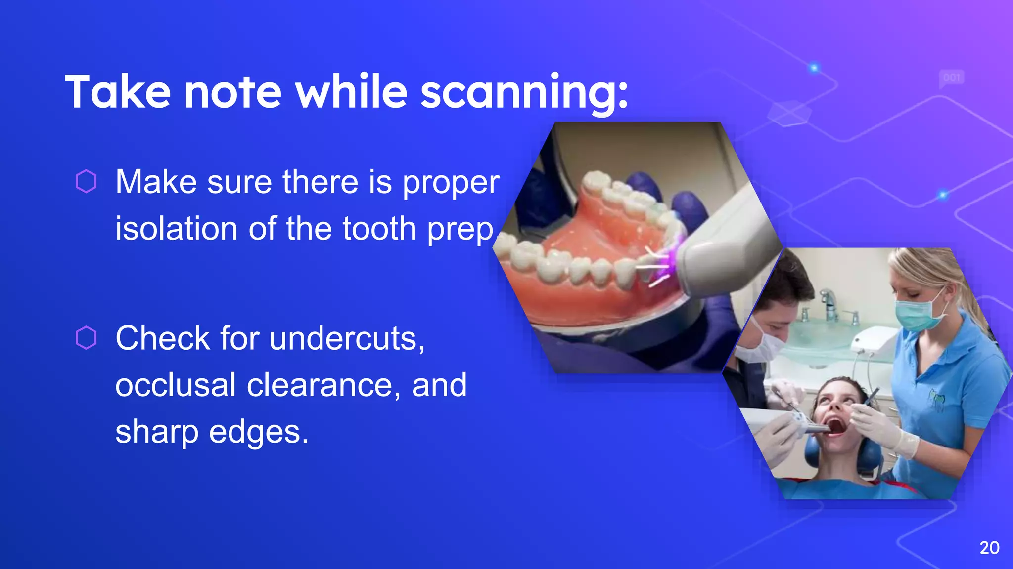 Cadcam in Dentistry | PPTX