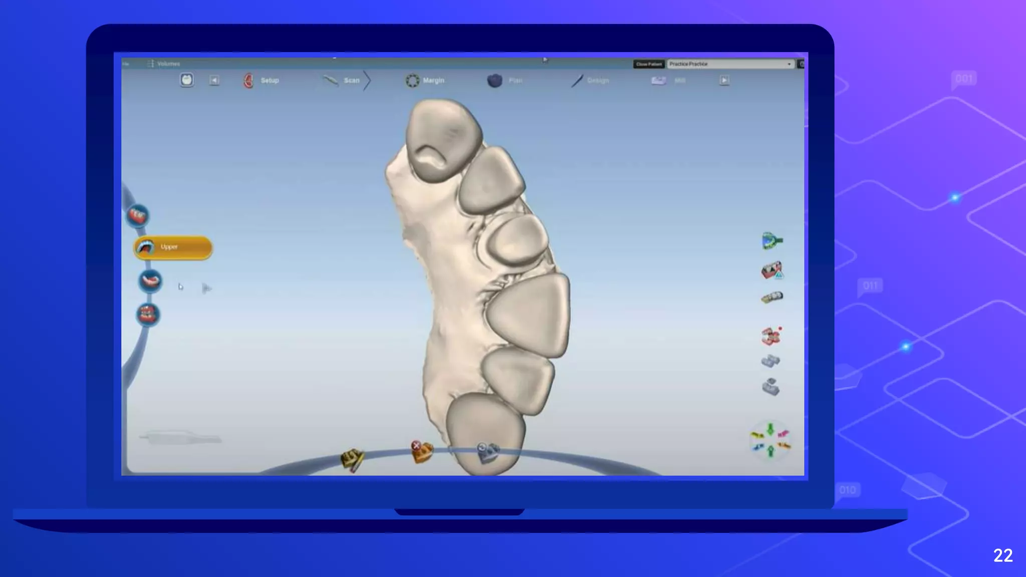 Cadcam in Dentistry | PPTX