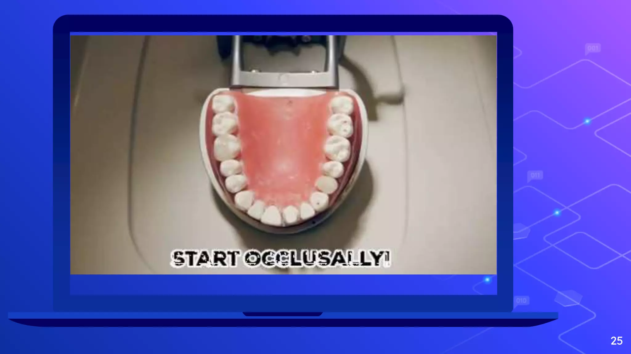 Cadcam in Dentistry | PPTX