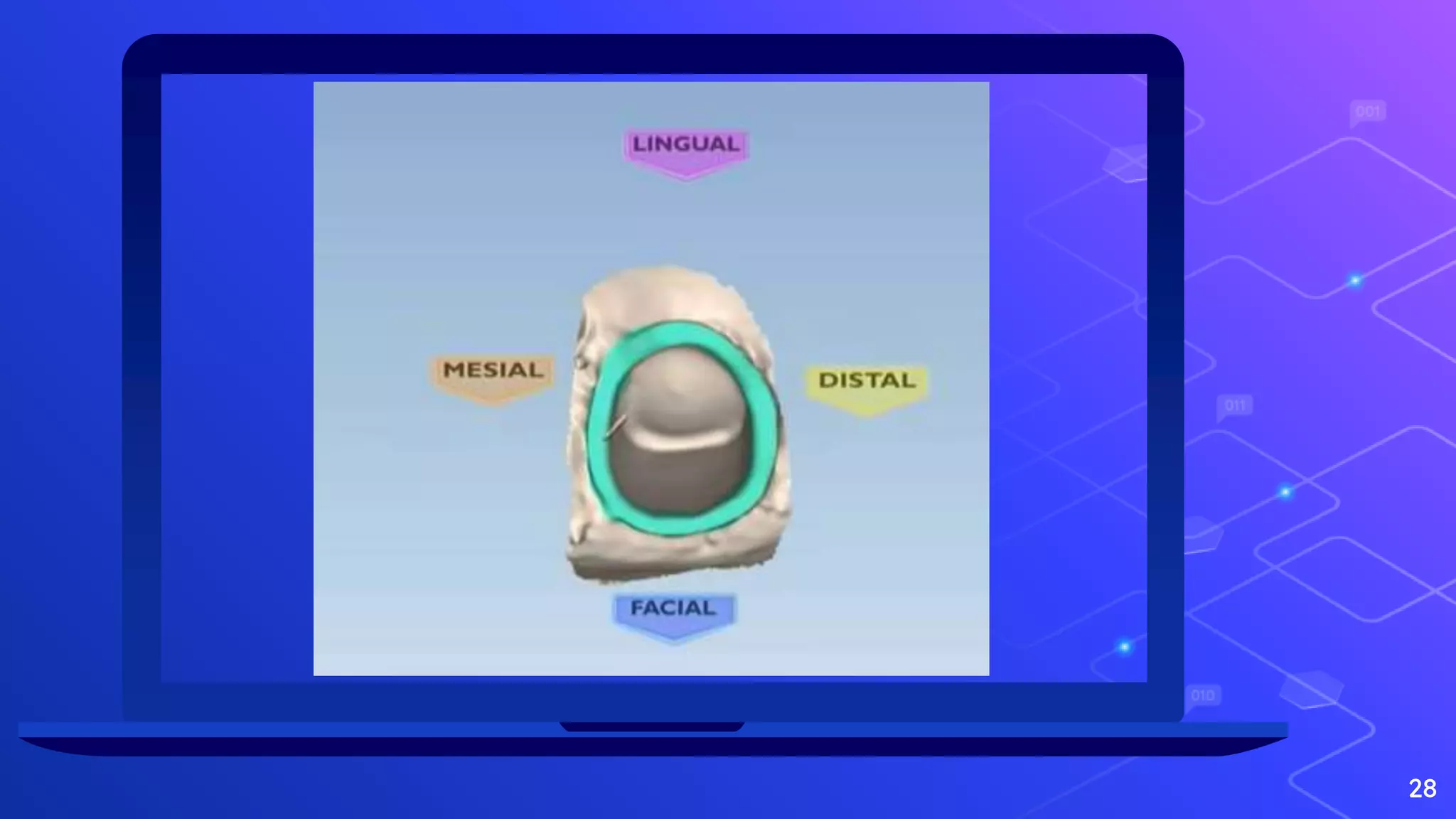 Cadcam in Dentistry | PPTX
