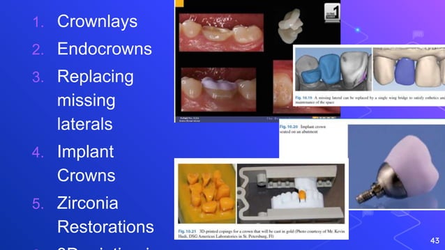 Cadcam in Dentistry | PPTX | Dental Health | Diseases and Conditions