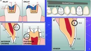 Cadcam in Dentistry | PPTX