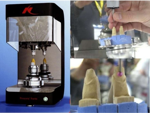 Cad Cam dentistry and digital impressions