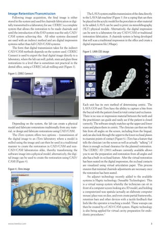 Cad cam digital_impressions till nya tandläkare | PDF | Oral care ...