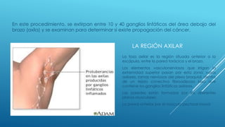 Cáncer de mama anatomia, fisiopatoliga tecnica quirurgic | PDF