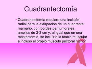 Cirugia Conservadora de Mama | PPT