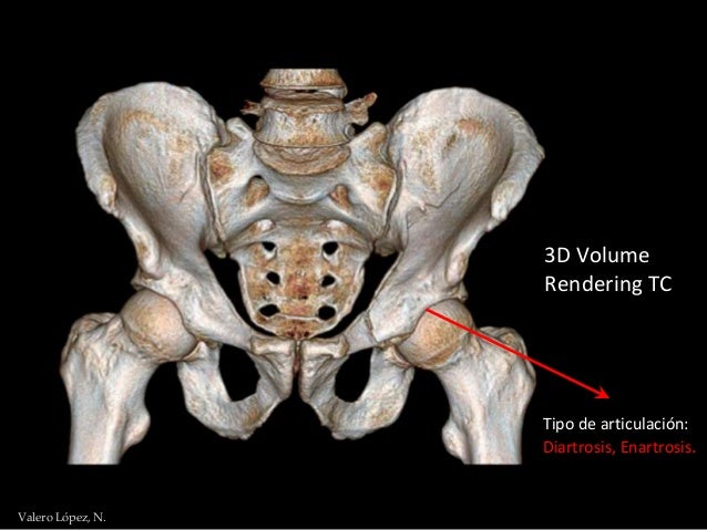 Imágenes radiológicas cadera. Radiografía. Radiodiagnóstico. Imagen p…