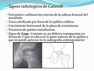 Cadera pediatrica | PPTX