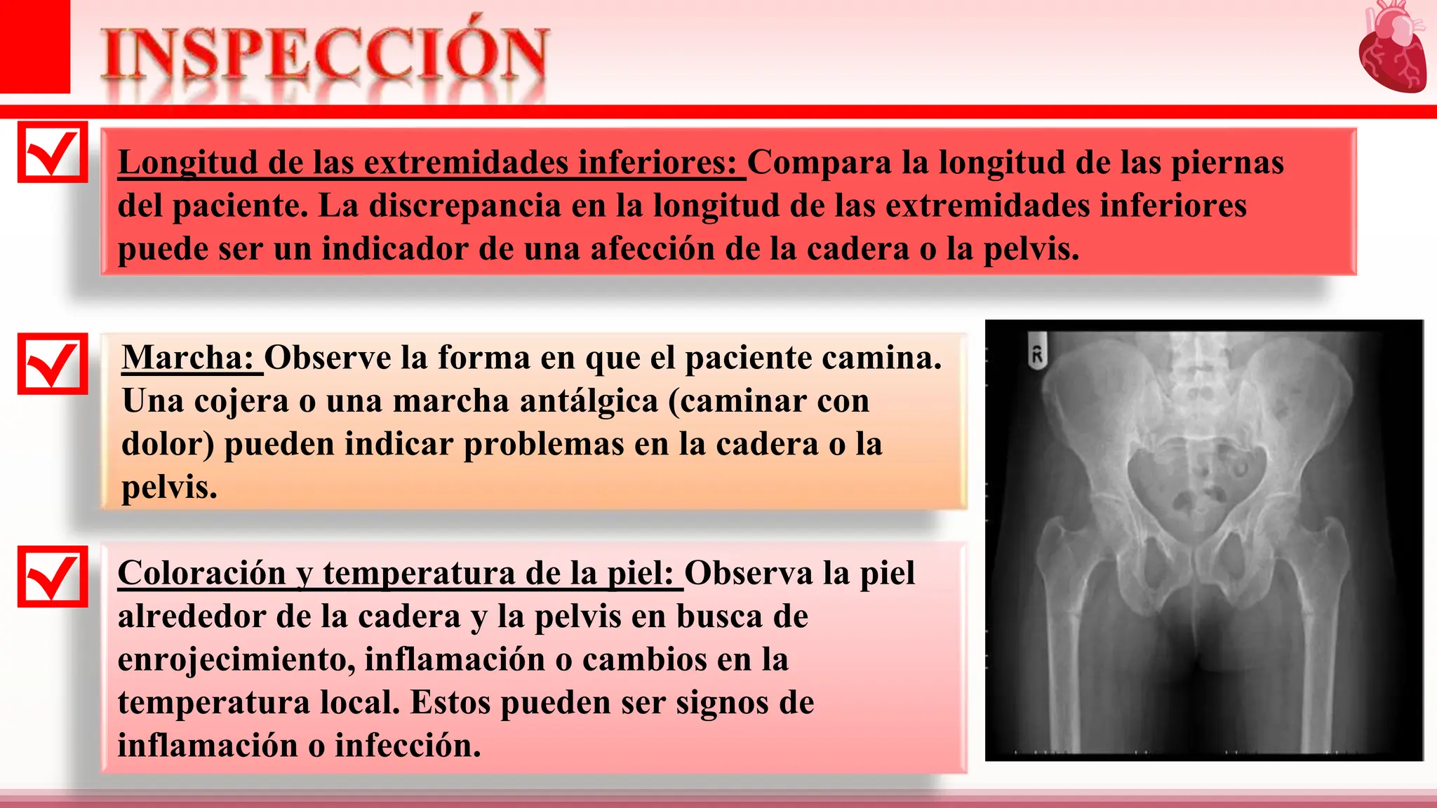 Anatomia y exploracion de CADERA Y PELVIS.pptx
