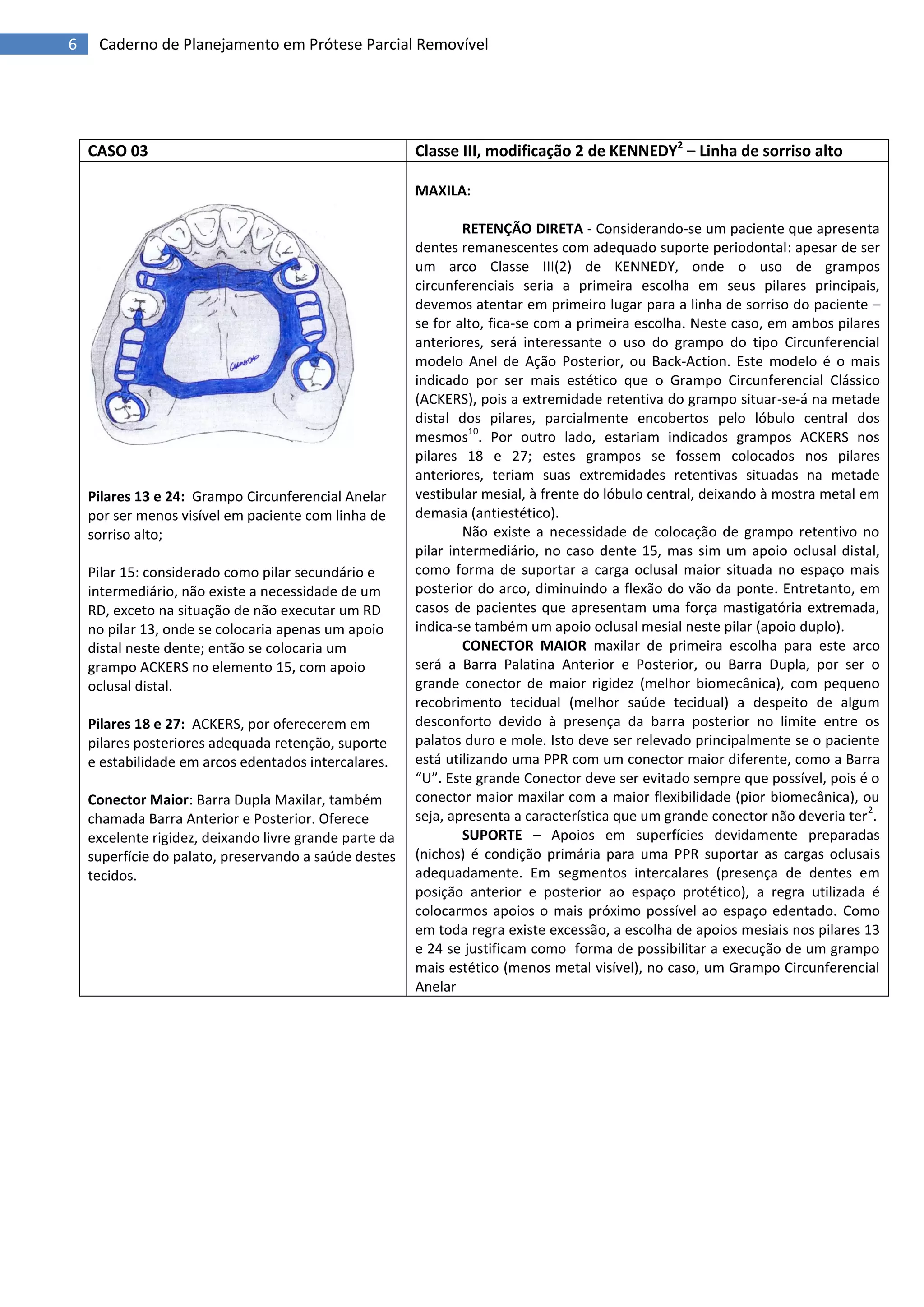 Planejamento em Prótese Parcila Removível | PDF