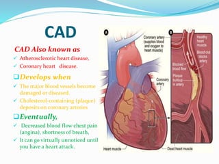 CORONARY ARTERY DISEASE WITH HYPERTENSION | PPTX