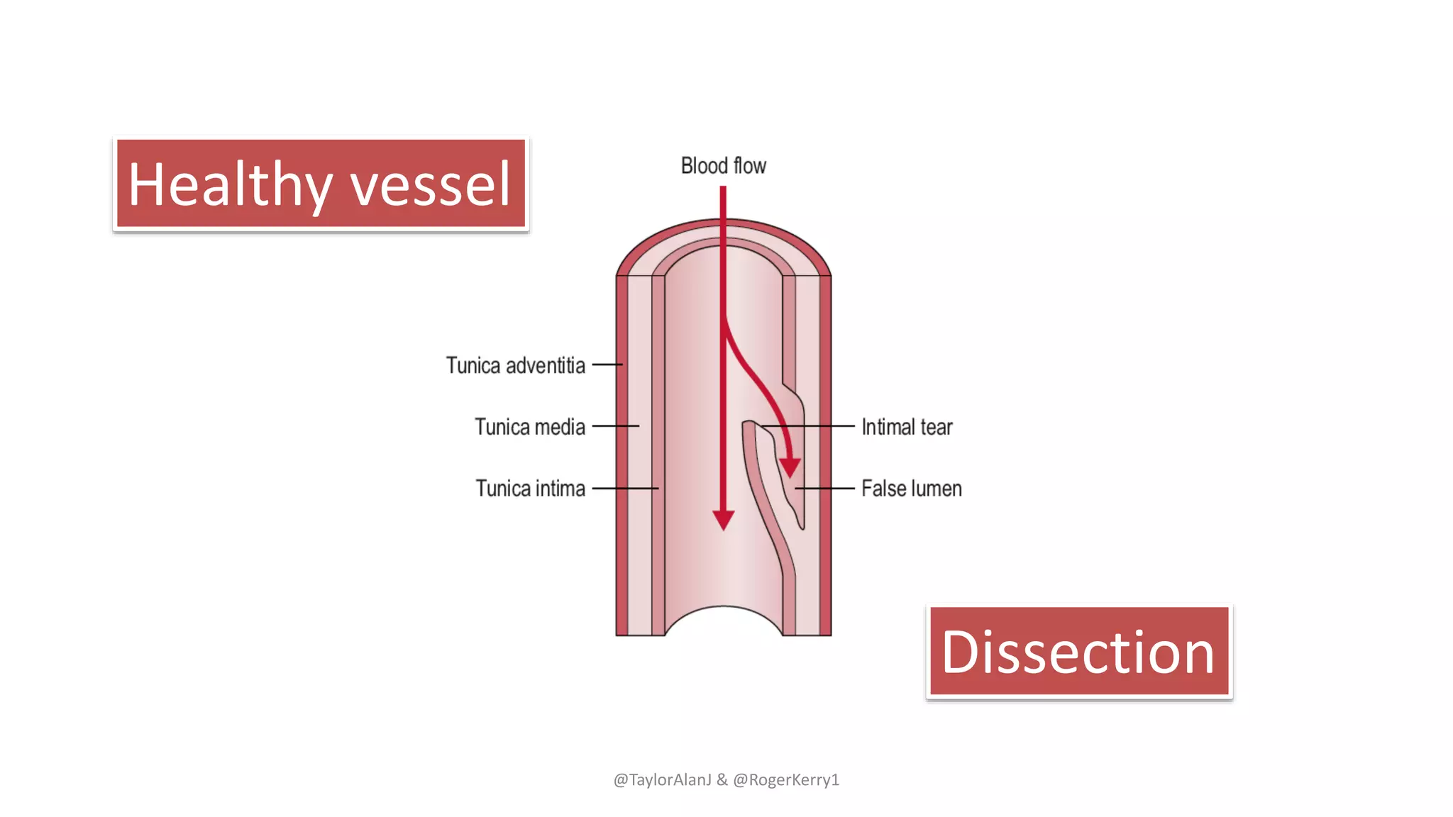 Cervical Arterial Dysfunction & Clinical Practice: Moving Forward | PPTX