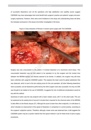 The Utility of the CADISS® System in the Dissection of Epidural ...