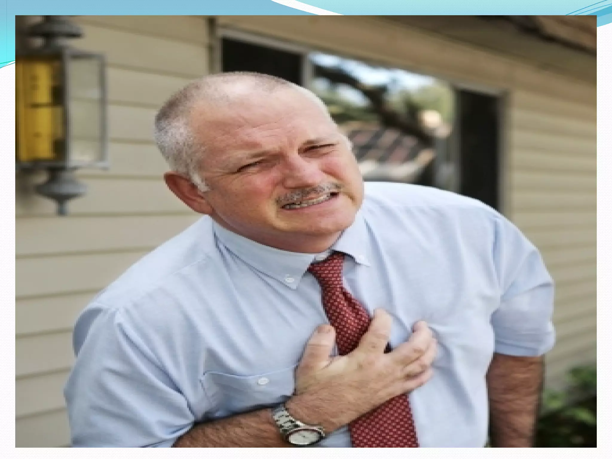 CAD AND MI (CORONARY ARTERY DISEASE AND MYOCARDIAL INFARCTION) | PDF