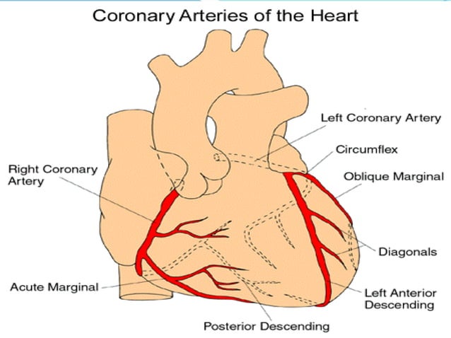 CAD AND MI (CORONARY ARTERY DISEASE AND MYOCARDIAL INFARCTION) | PDF