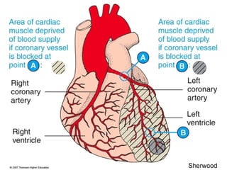 CAD AND MI (CORONARY ARTERY DISEASE AND MYOCARDIAL INFARCTION) | PDF