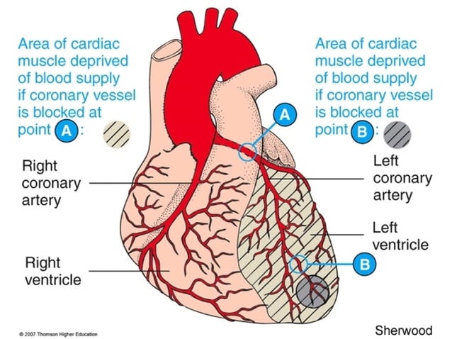 CAD AND MI (CORONARY ARTERY DISEASE AND MYOCARDIAL INFARCTION) | PDF