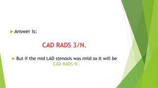 CAD RADS | PPTX