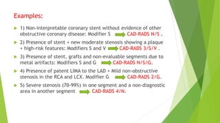 CAD RADS | PPT