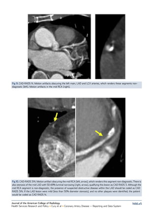 CAD RADS: Coronary Artery | PDF