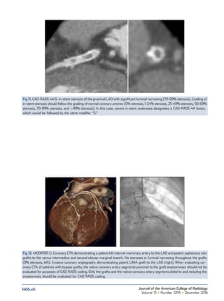 CAD RADS: Coronary Artery | PDF