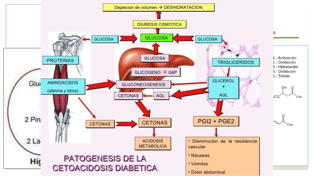 Cetoacidosis diabetica y Estado hiperosmolar hiperglucemico
