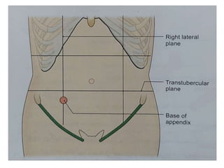 Caecum and vermiform appendix | PPTX