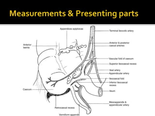 Caecum Jejunum Paracolic Gutters Intestine Duodenum Watershed Between ...