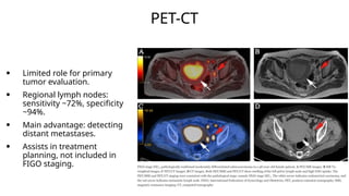 CA ENDOMETRIUM.pptx CA ENDOMETRIUM PPT CA | PPTX