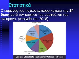 Καρκίνος Παχέος εντέρου | PPTX