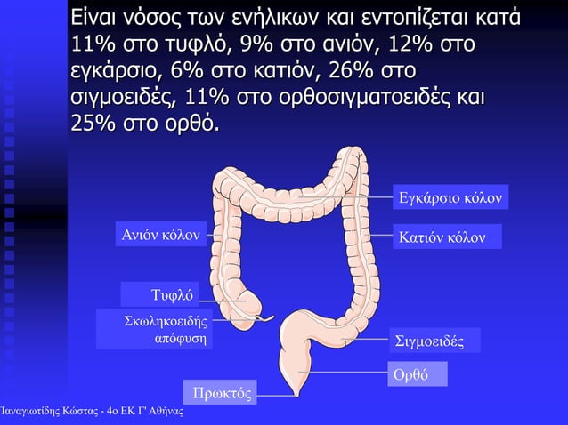 Καρκίνος Παχέος εντέρου | PPTX