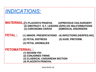 CAESAREAN SECTON | PPT