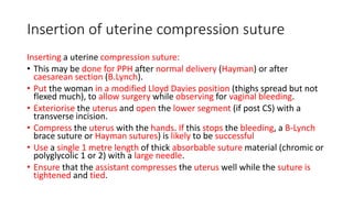 Caesarean delivery.pptx