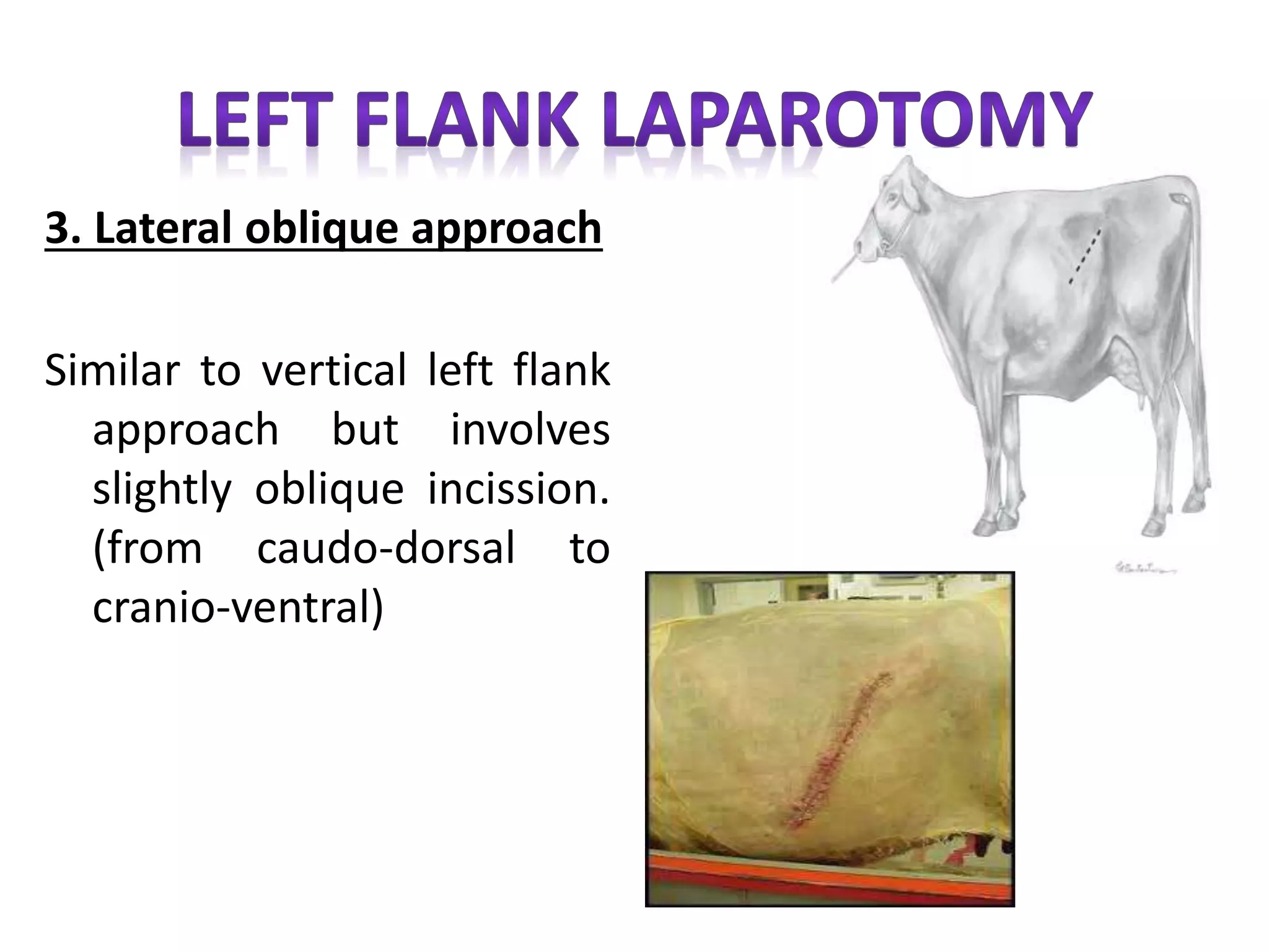 caesarean operation.pptx