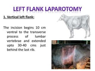 caesarean operation.pptx