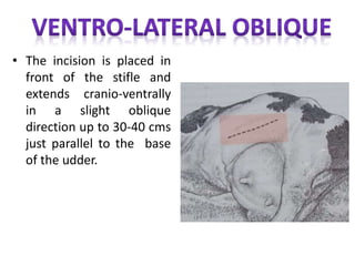 caesarean operation.pptx