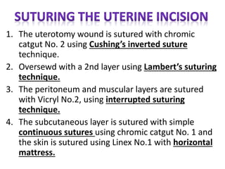 caesarean operation.pptx