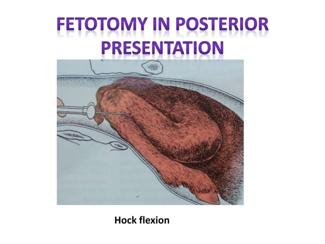 caesarean operation.pptx