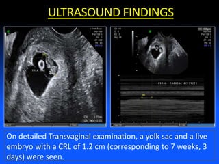 Caesarean scar pregnancy.ppt
