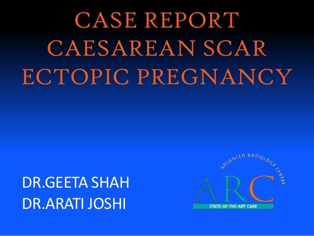 Caesarean Scar Pregnancy Ppt