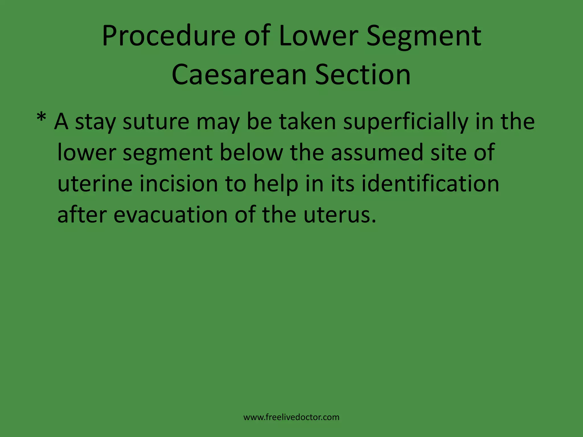 Caesarean section | PPTX