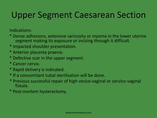 Caesarean section | PPTX