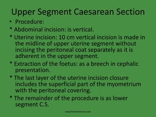Caesarean section | PPTX