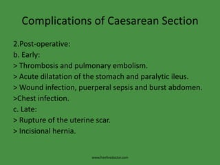 Caesarean section | PPTX