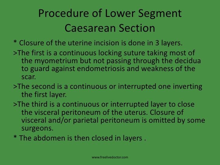 Caesarean section