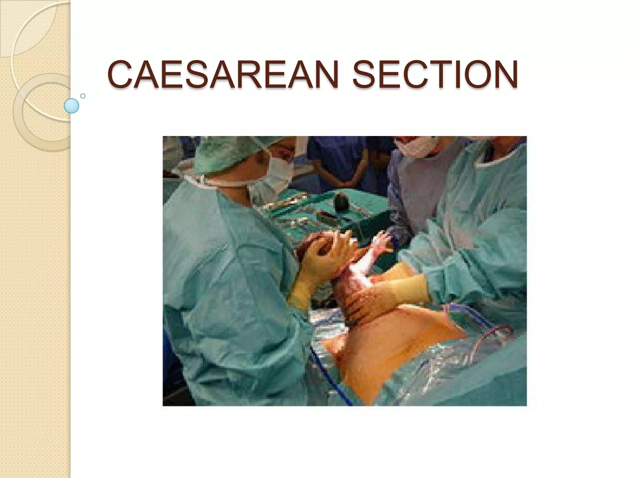 Caesarean section | PPTX