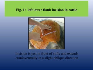 Caesareansection | PPT